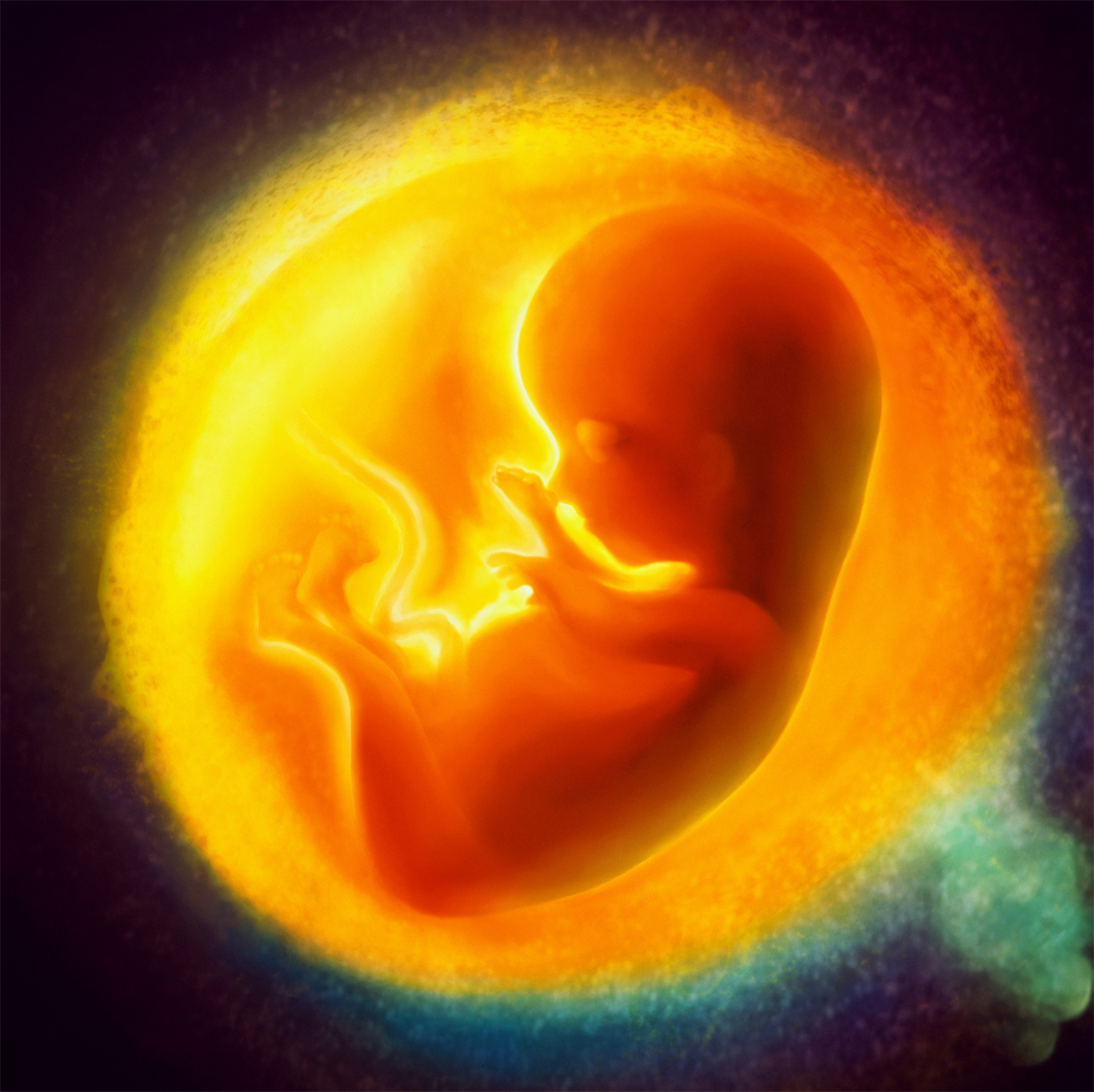 MPs approve Northern Ireland Abortion Regulations | David Scullion ...